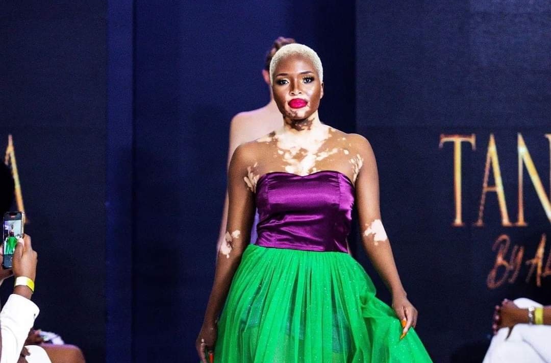 Yolanda’s fans raised R1 Million for her after disqualification from ...